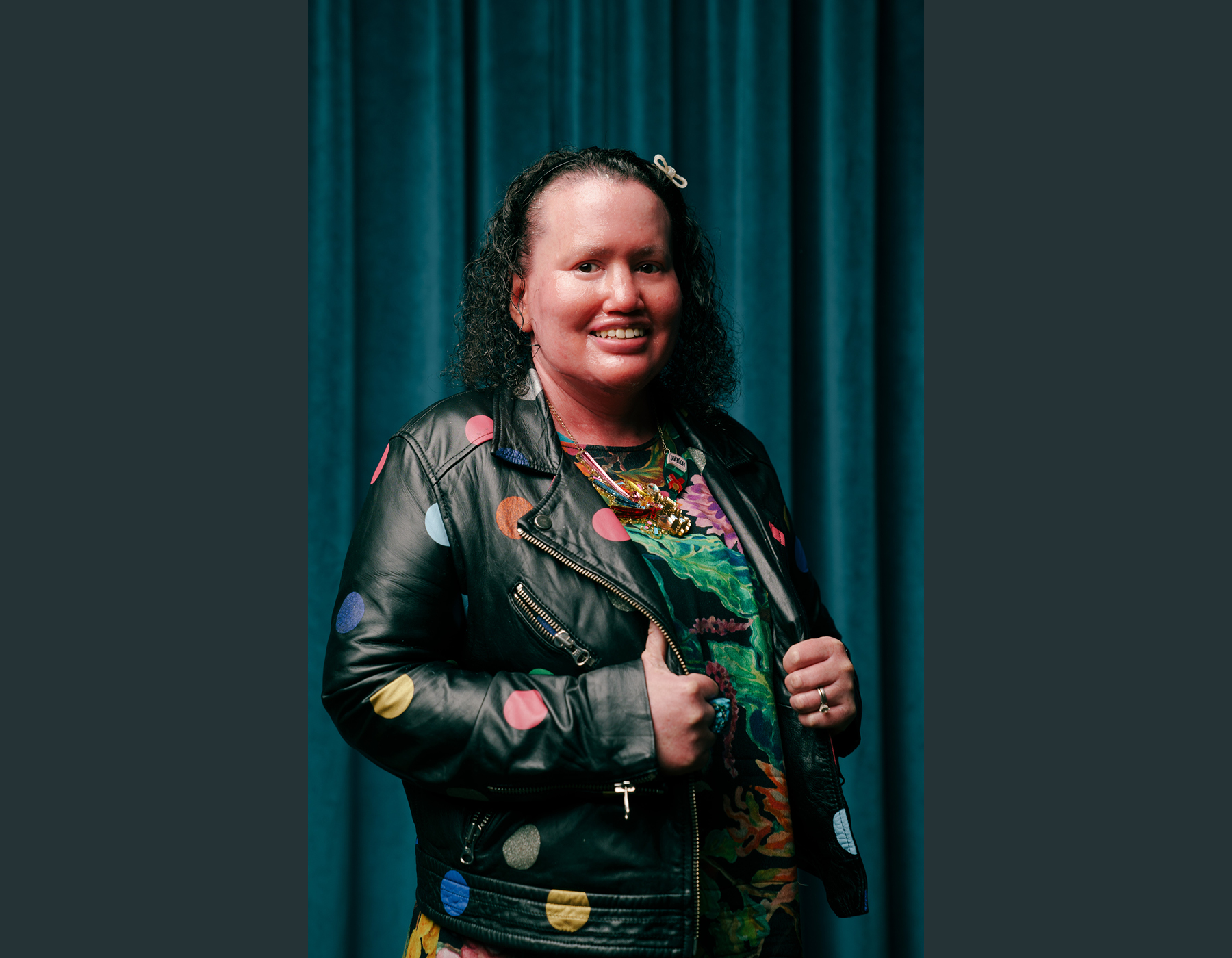 打破壁垒3大要点：为残疾员工创造公平而包容的工作环境 | 《CEO杂志》